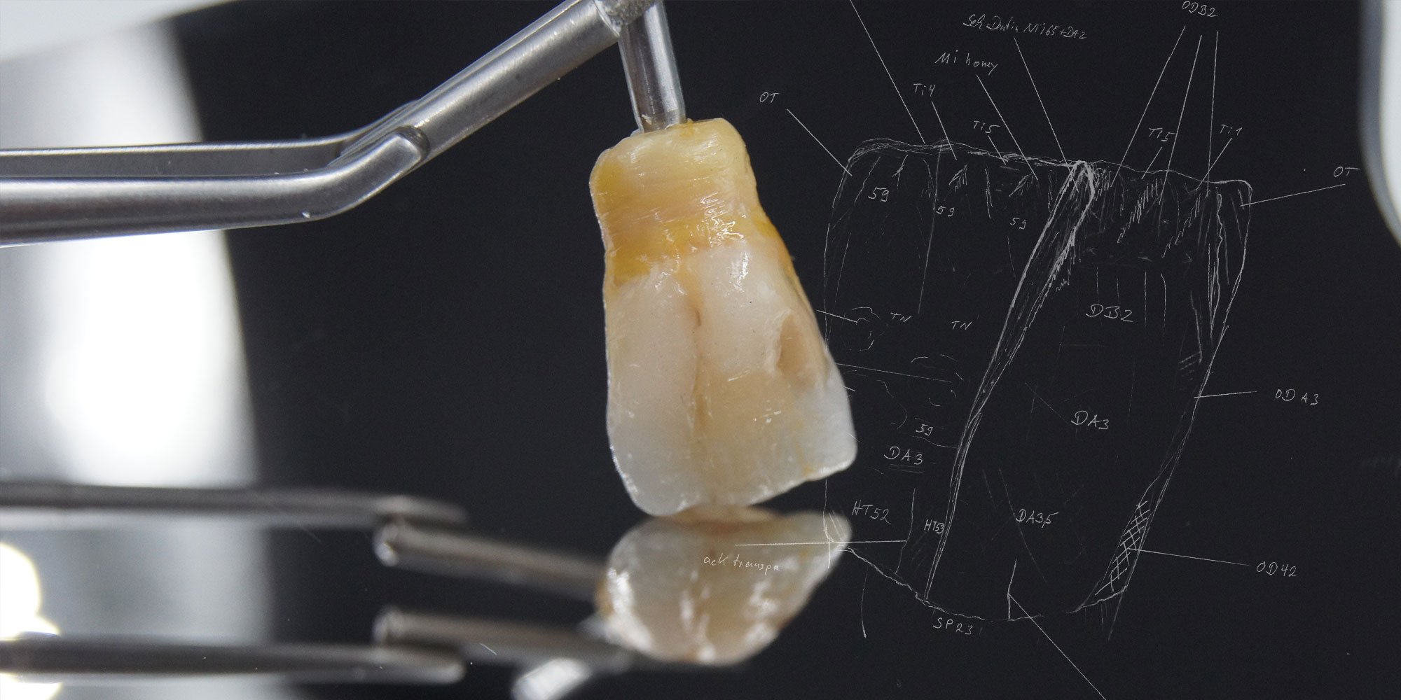 Zahnwerk Winkelhake | Ihr Dentallabor in Bückeburg